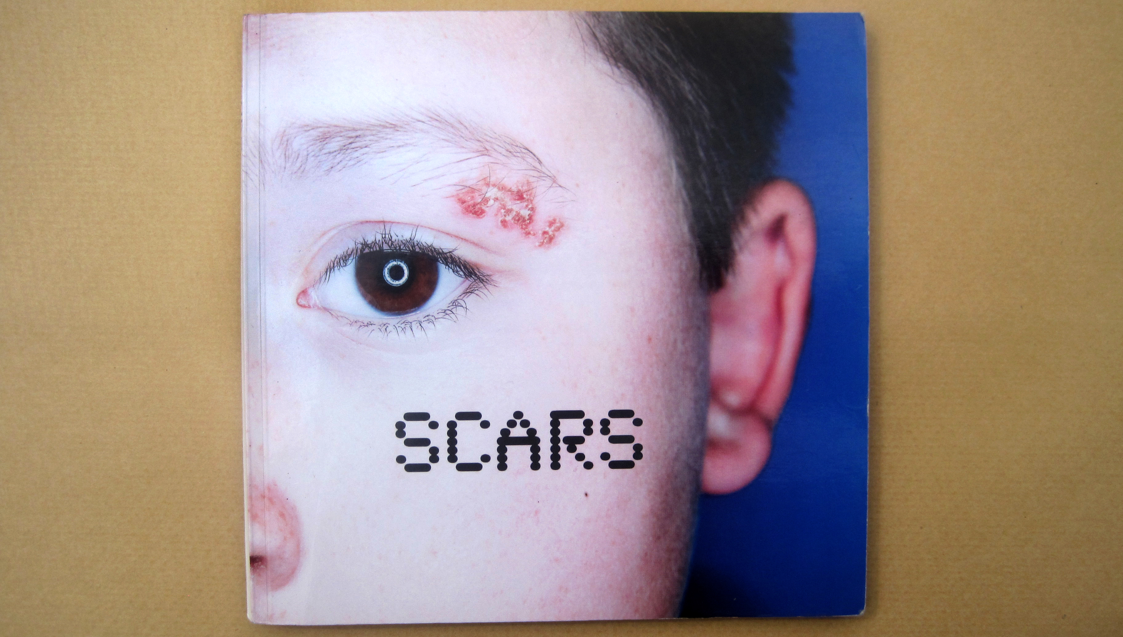Scars Project (2009)